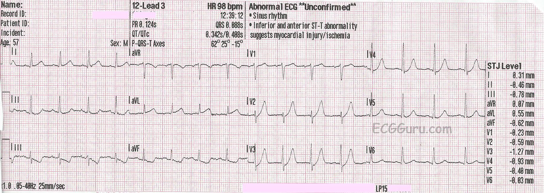 OMI | ECG Guru - Instructor Resources